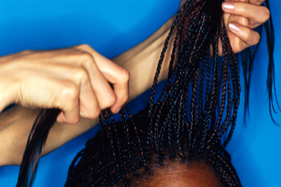 7 Easy Ways to Get Rid of Painful Bumps from Braids