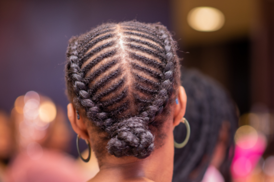 7 Easy Ways to Get Rid of Painful Bumps from Braids